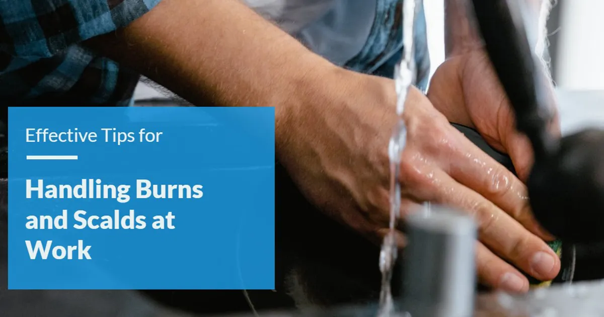 Effective First Aid Tips for Handling Burns and Scalds at Work ...